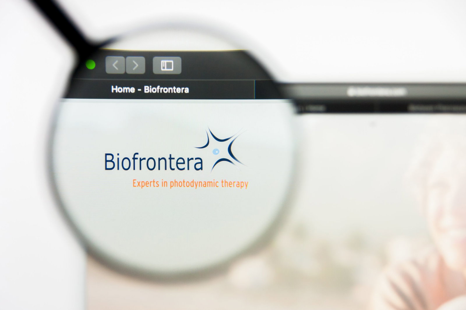 Biofrontera-Aktie: Sollten Sie jetzt kaufen? - Finanztrends